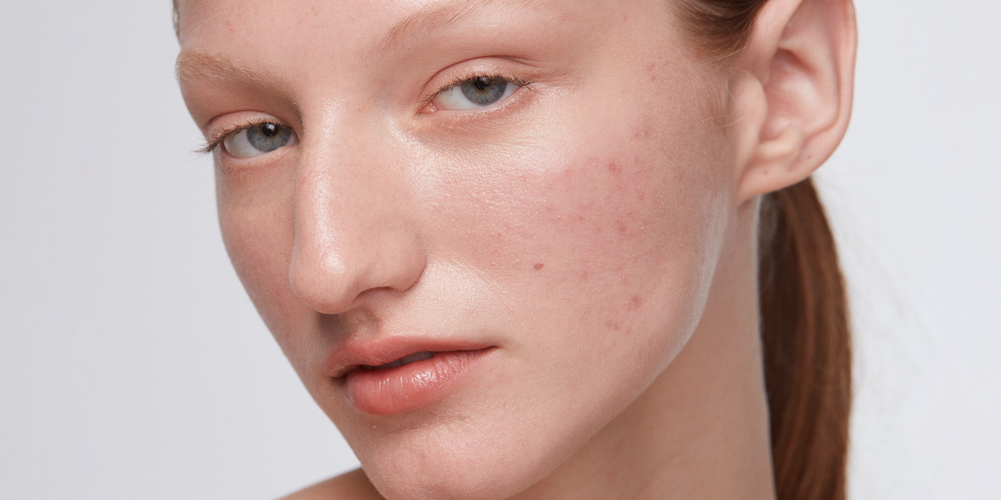 Piel grasa: cómo cuidarla para lucir una piel sana e hidratada ...